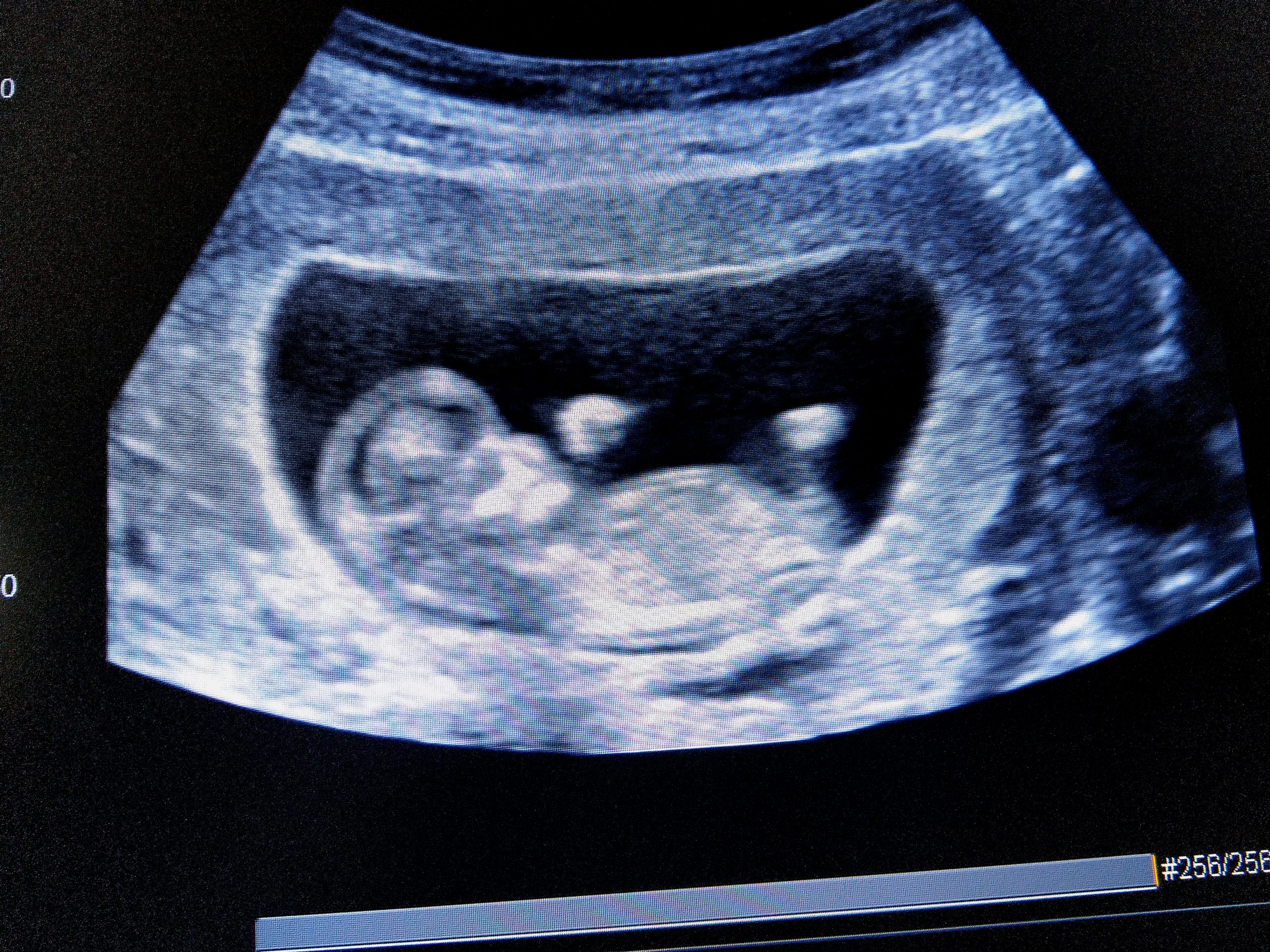 Schwangerschaftswoche 11 - Swissfamily